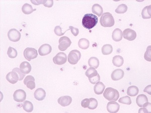 Medical Laboratory Professionals